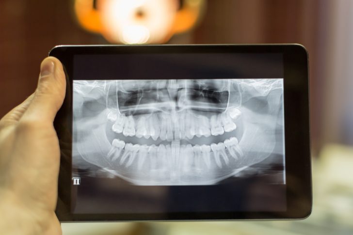 Digital Dentistry Is Revolutionizing the Patient Experience - | - thirdAGE