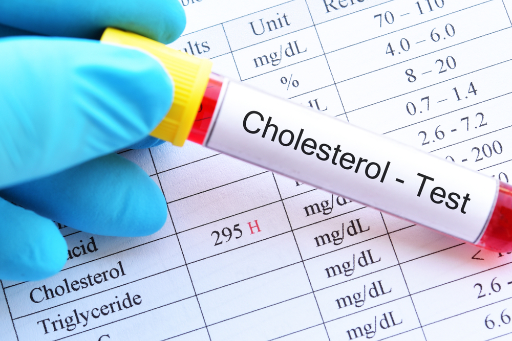 Cholesterol Tests From A to Z