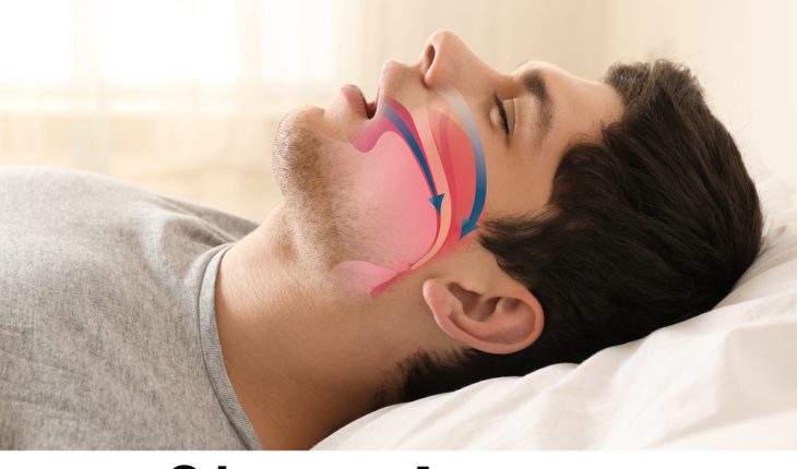 4 Undiscussed But Serious Side Effects of Sleep Apnea - | - thirdAGE