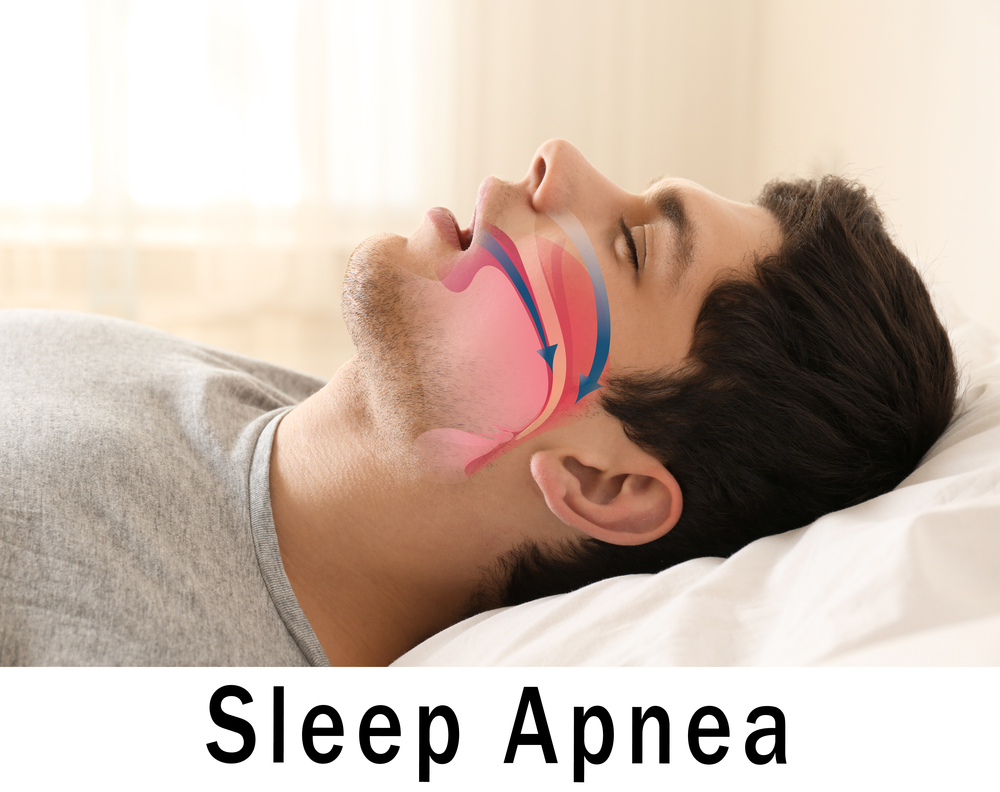 4 Undiscussed But Serious Side Effects of Sleep Apnea - | - thirdAGE